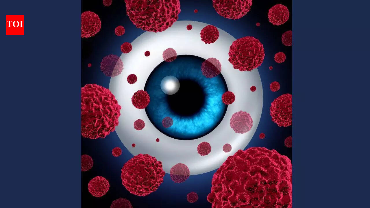Eye cancer common signs and symptoms that you should know | - The Times ...