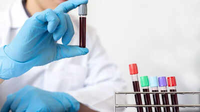 World’s first rare blood group found in Bangalore woman, marking a ...