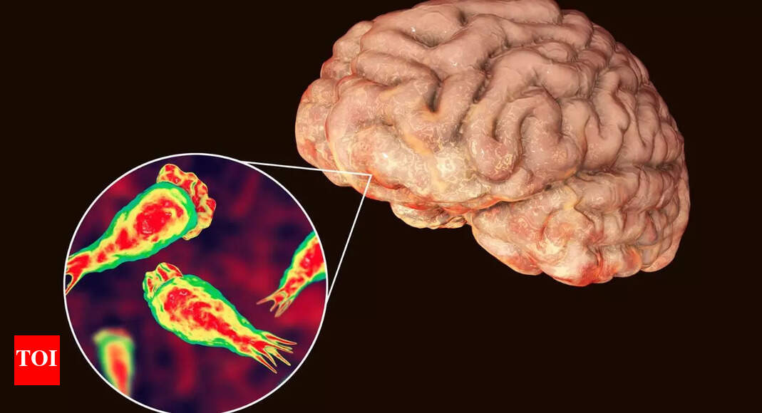 Brain-Eating Amoeba Symptoms: 9-year-old girl dies due to 'brain-eating ...