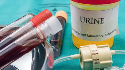 What a urine test reveals about your health: Early signs of kidney ...