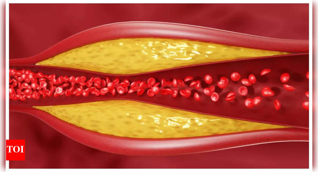 Hdl Vs Ldl Vs Triglycerides How To Optimally Manage Each Form Of