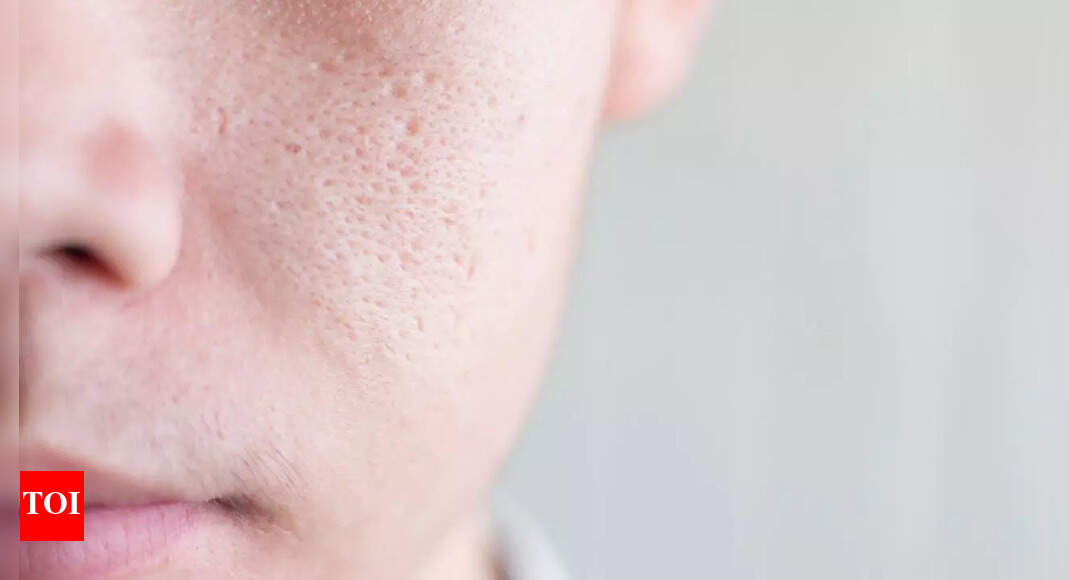 8 effective tips to reduce large pores for smoother skin | - The Times ...