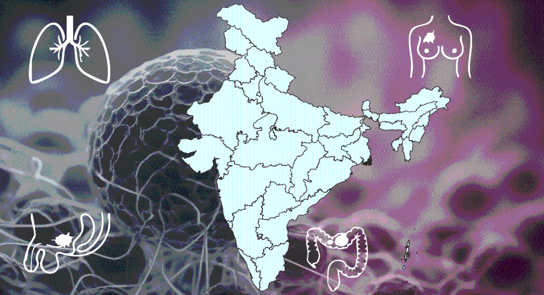 Why India’s alarming cancer crisis can no longer be hidden - The Times ...