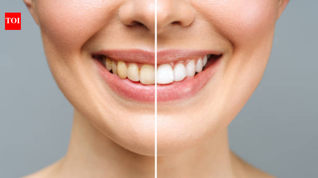 How to whiten teeth naturally (without spending a fortune)