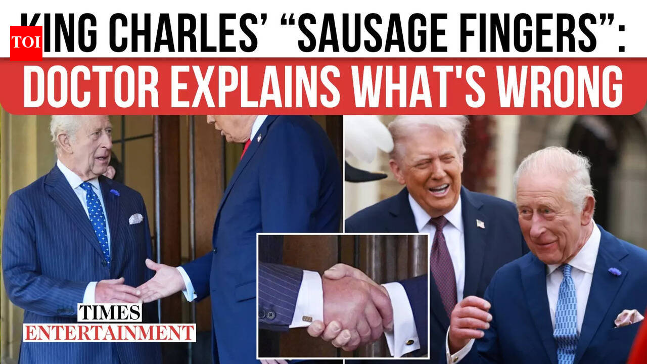 Doctor Drops BOMBSHELL on King Charles’ ‘Sausage Fingers’ After Trump’s ...