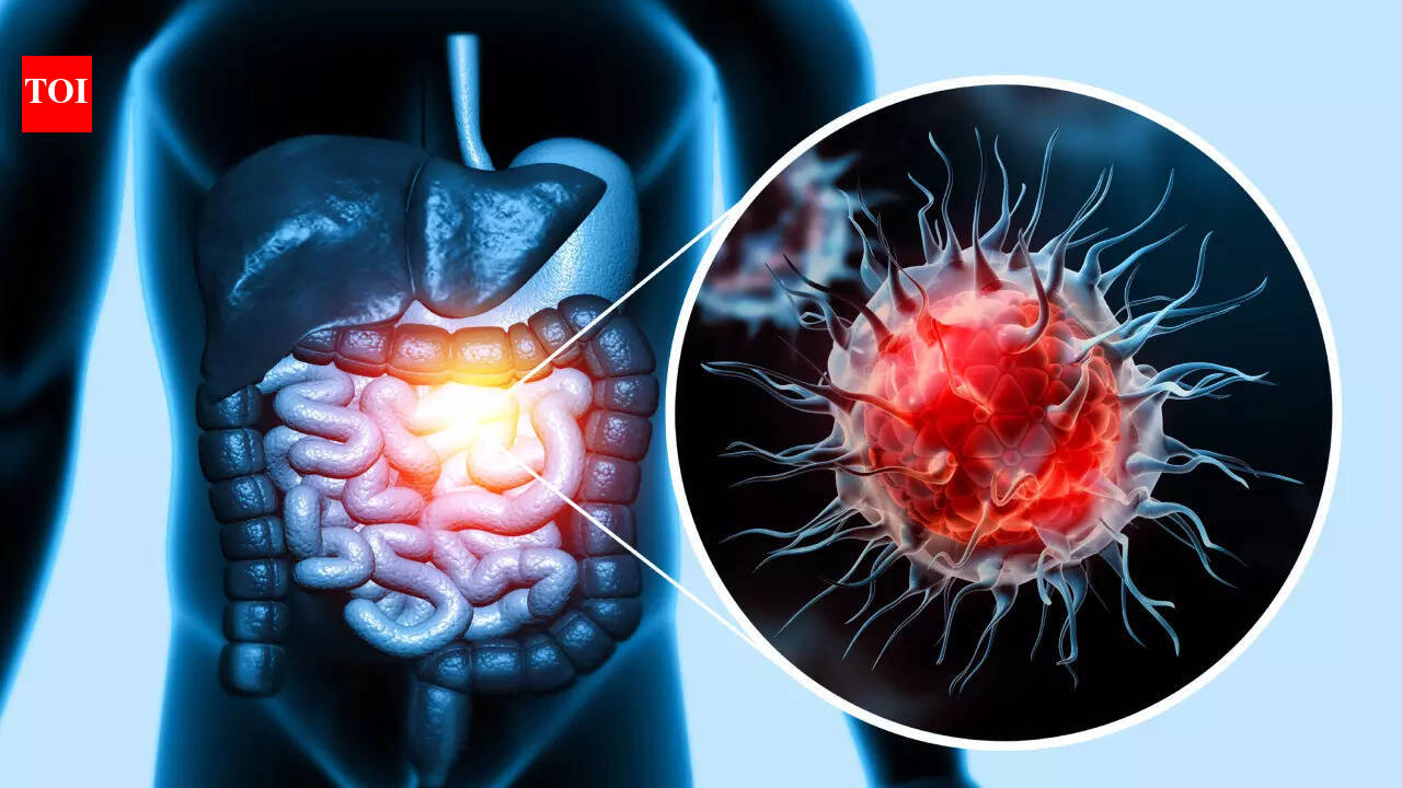 Colon cancer symptoms that often appear without pain