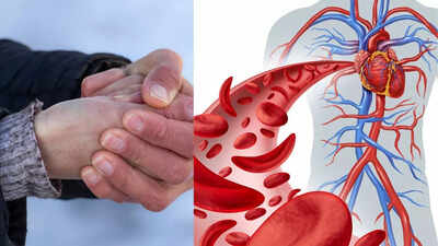 Cold hands and feet could be a serious warning sign: Know why your ...
