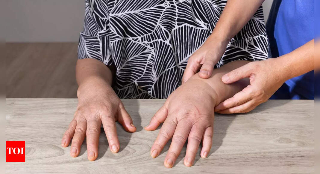 What causes swelling in fingers: Know 8 common reasons behind it ...