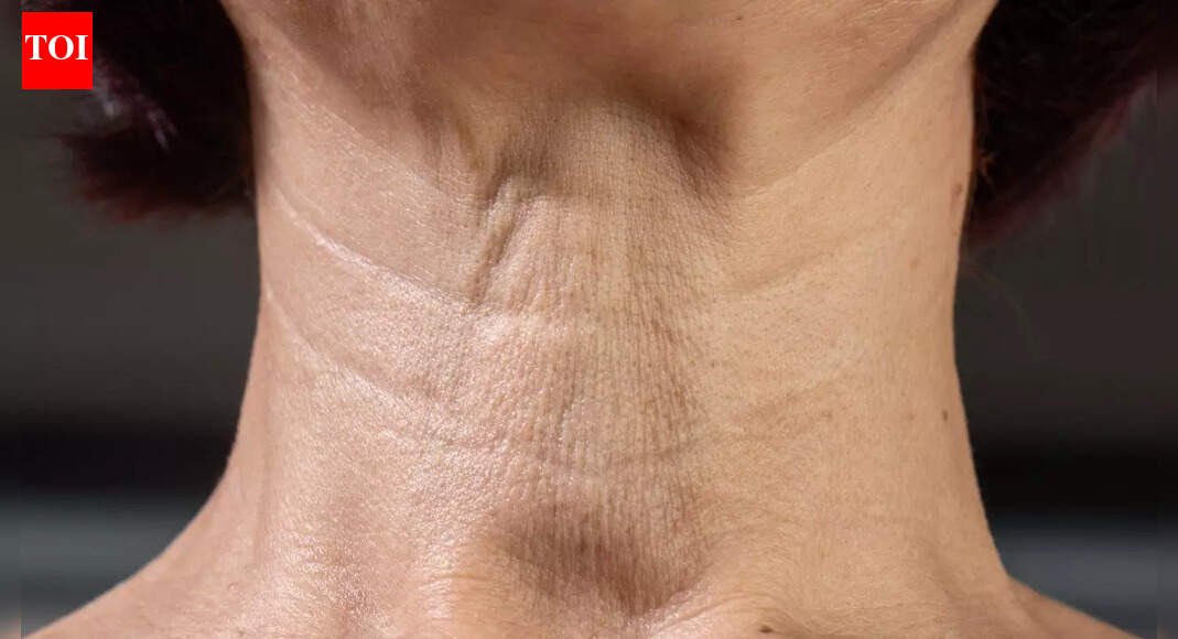 4 exercises to remove neck lines naturally and tighten sagging skin ...