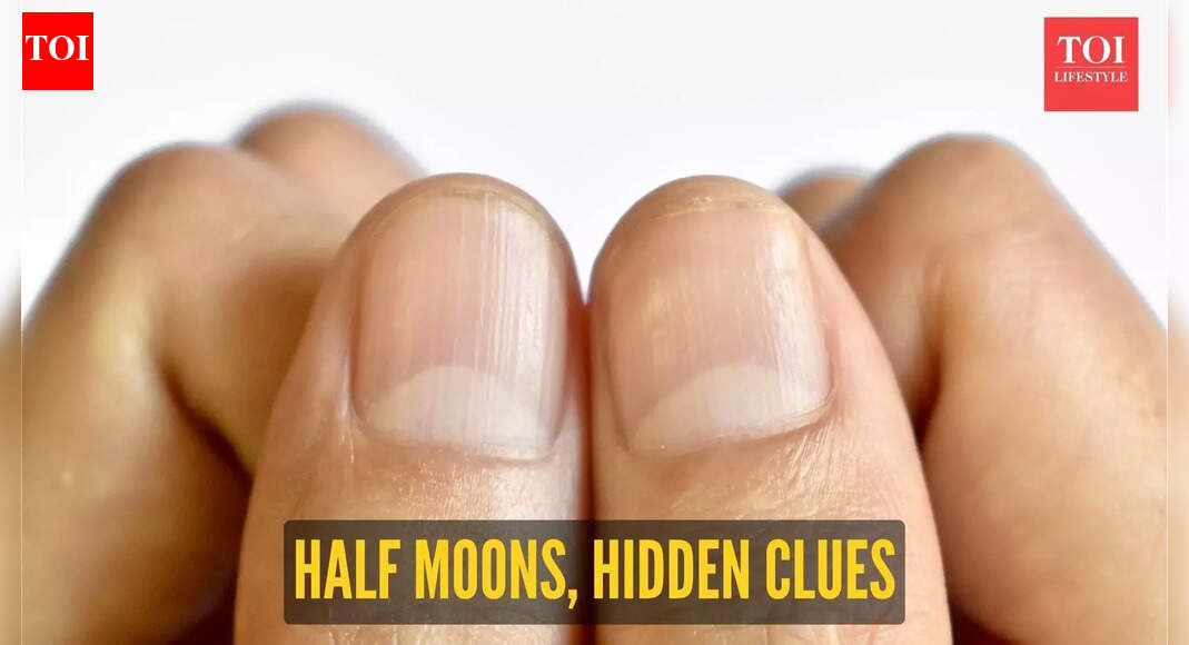 From kidney disease to heart health: What our nail’s half moon says ...
