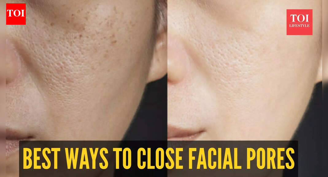 How to close open pores of face