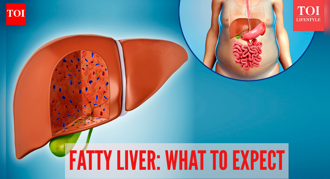 4 stages of fatty liver disease explained: Symptoms, risks, and recovery