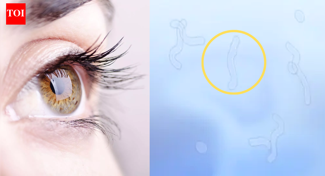 Eye Floaters: Seeing spots in your vision? Doctors reveal what’s ...