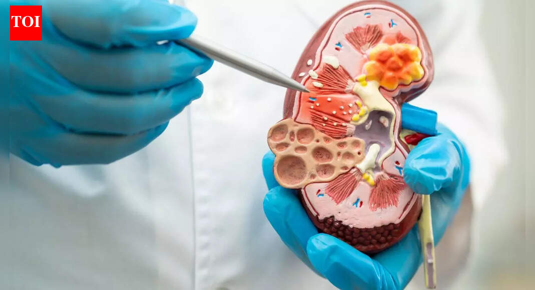 Understanding high creatinine levels: Causes, symptoms, and what they ...