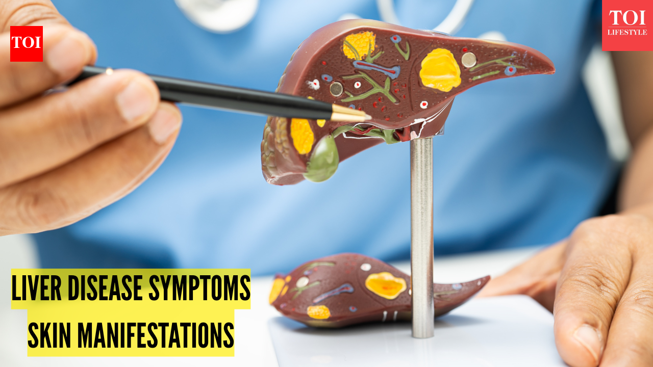 4 prominent liver damage warning symptoms that show on skin