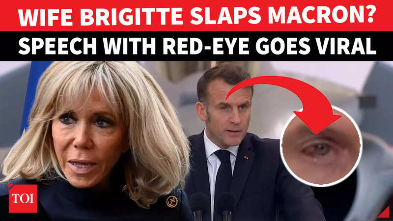 Macron Appears With Red Eye; Rumours Mill In Overdrive; Another Bloody ...