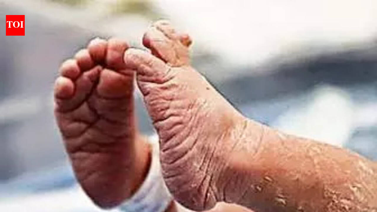 16-year-old delivers stillborn baby at exam centre | Hyderabad News ...