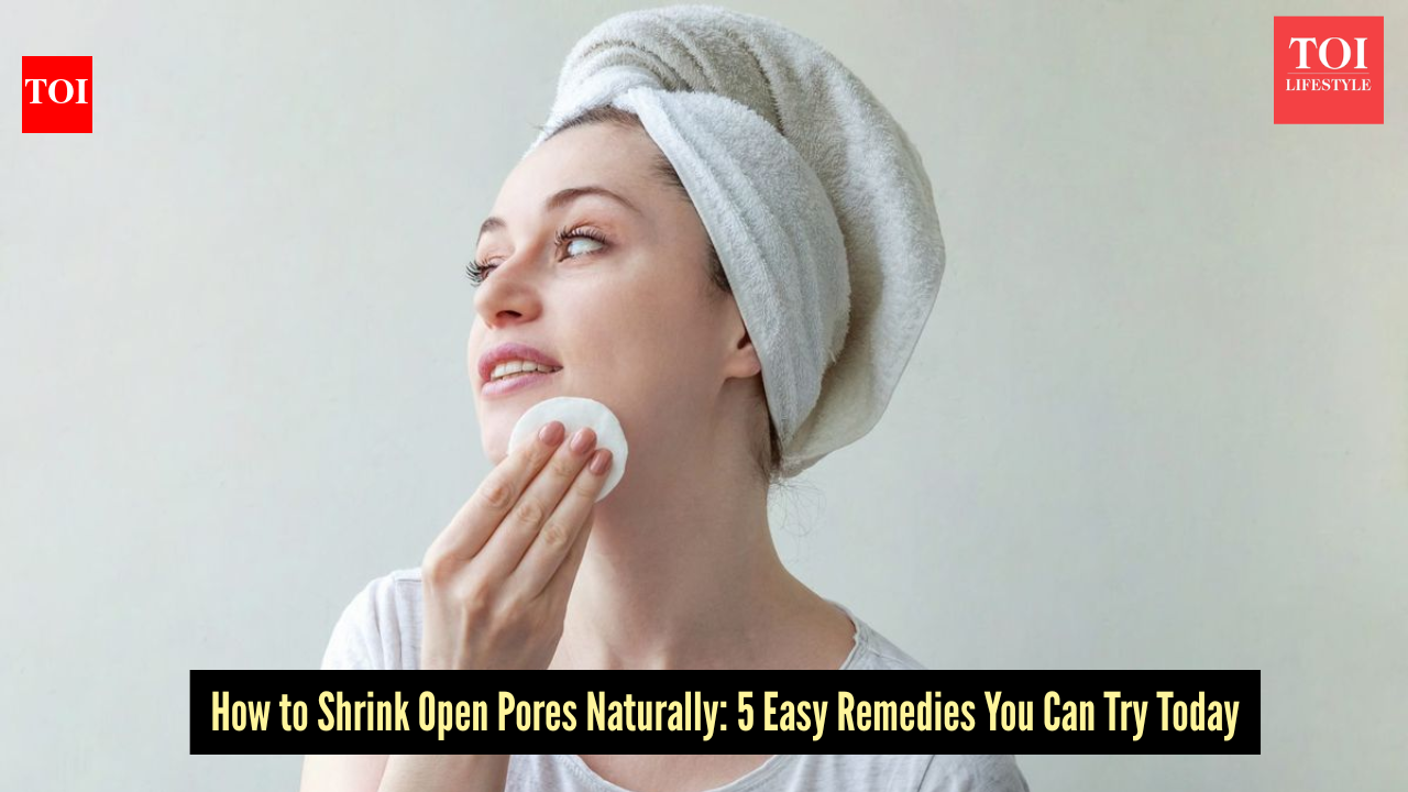 How to reduce trapped pores naturally at home? 5 easy remedies you can ...