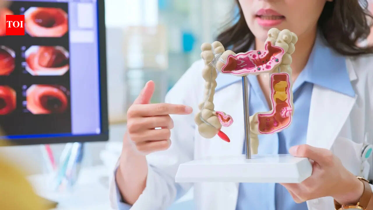 Colon cancer in young: 4 early warning signs you should not ignore ...