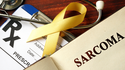 Rare sarcoma misdiagnosed for years: Why accurate cancer diagnosis ...