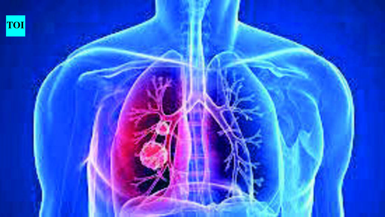 Hyd student develops AI model for early lung cancer detection ...