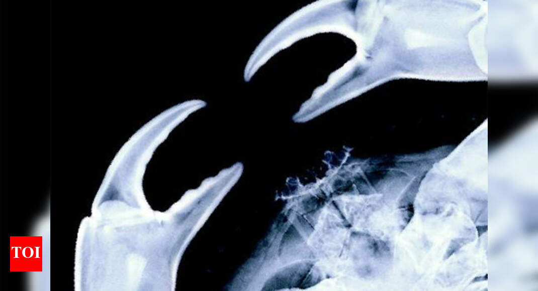 10 simple tips to cut cancer risk - Times of India