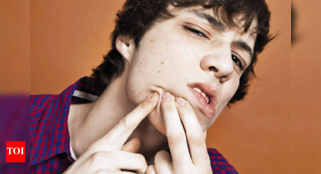 Busting acne myths - Times of India