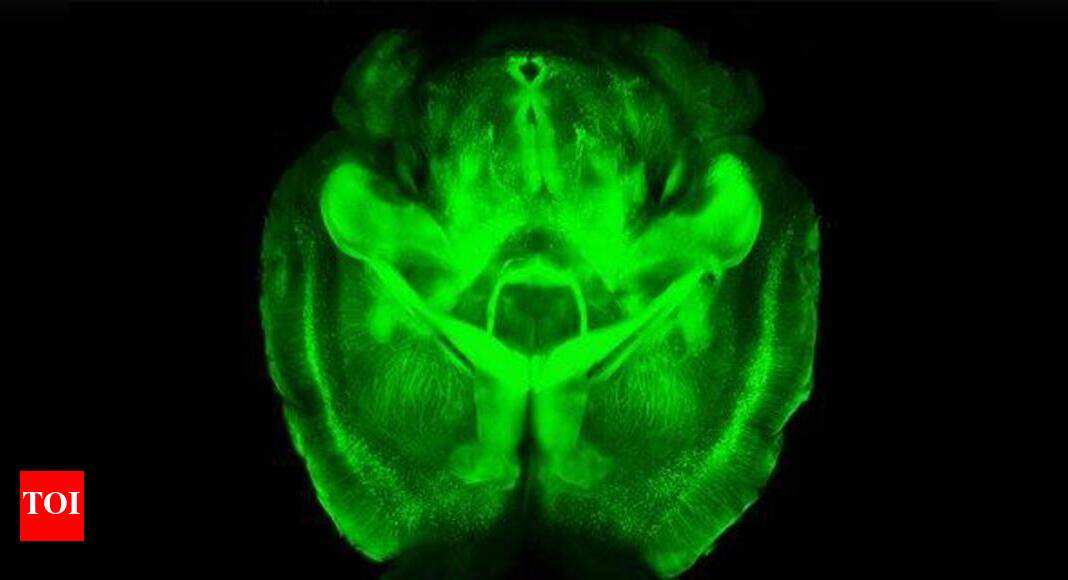 Skin cells directly turned into brain cells - Times of India