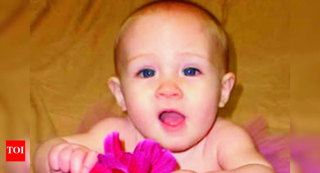 Bald baby problem? Here's how to hide it - Times of India