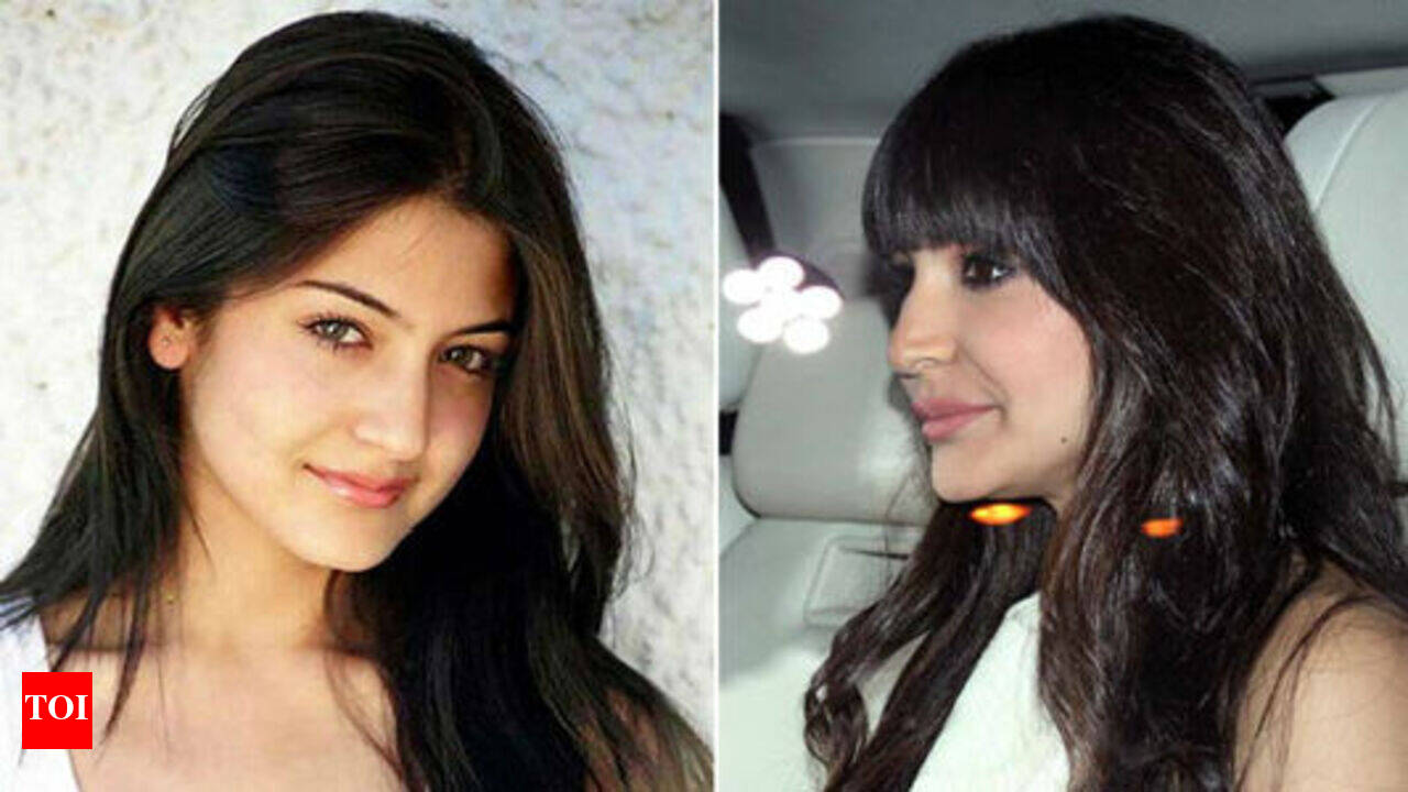 Anushka Sharma Before And After Surgery