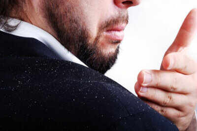 Major hair issues men face - Times of India