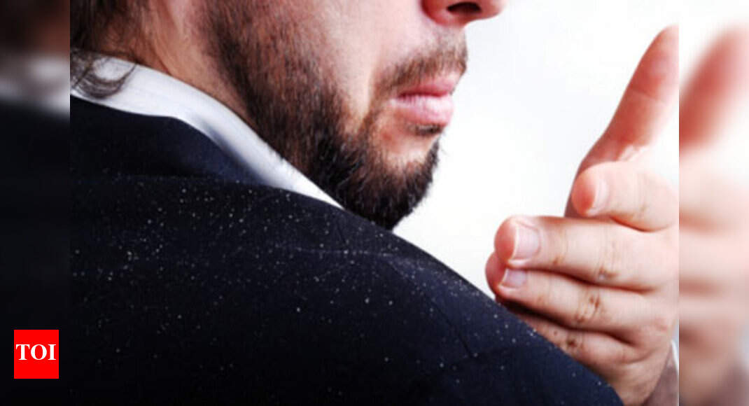 Major hair issues men face - Times of India