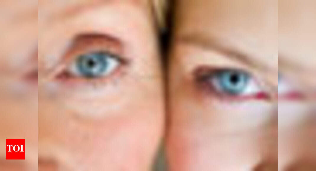 Remove wrinkles forever! - Times of India