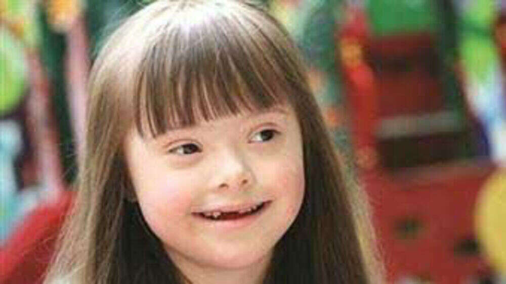 Why are the words 'mongol', 'mongoloid' and 'mongy' still bandied about ...