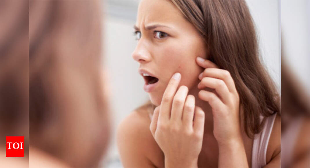 How to keep winter acne at bay - Times of India