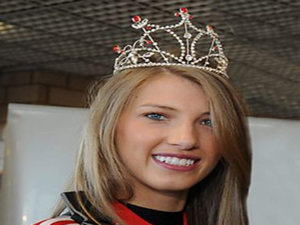 Brutal attack knocked out beauty queen's teeth