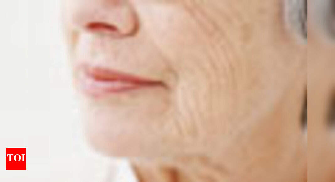 Genetic mutation linked to wrinkles found - Times of India