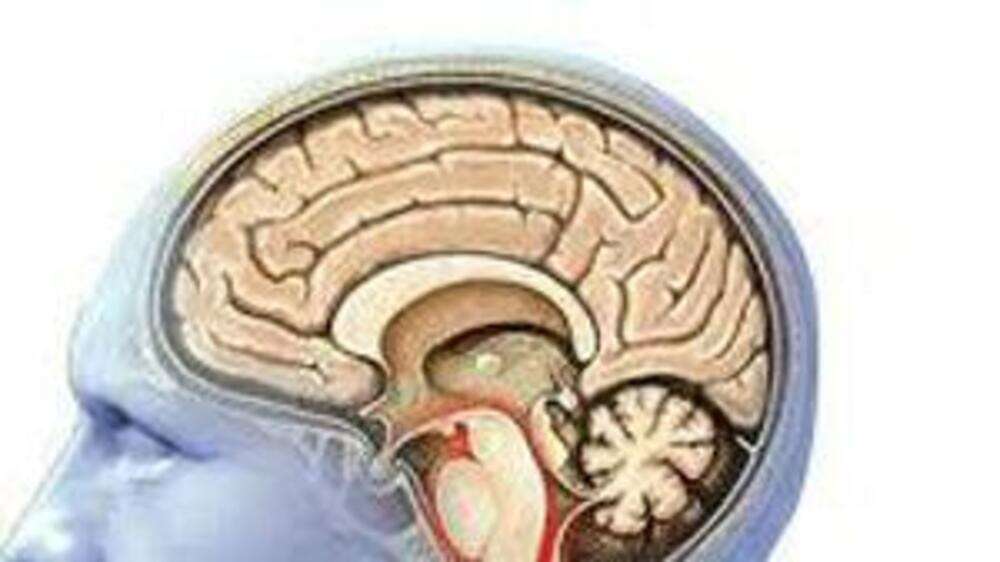 What is Cotard's syndrome? The rare mental illness which makes people ...