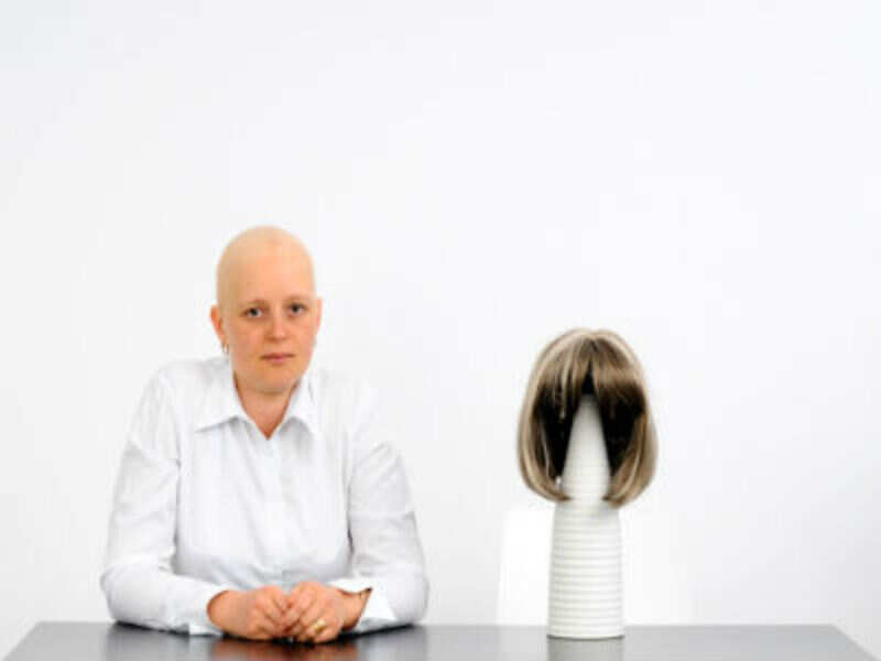 Cancer treatment that minimises hair loss and skin damage - Times of India