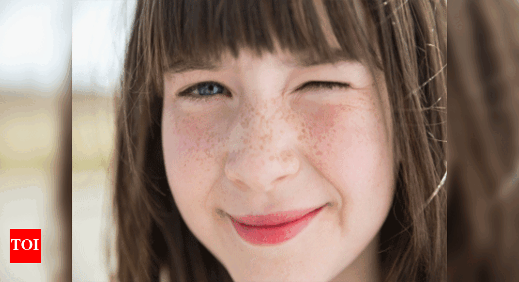 Faux freckles make waves in fashion circuits - Times of India