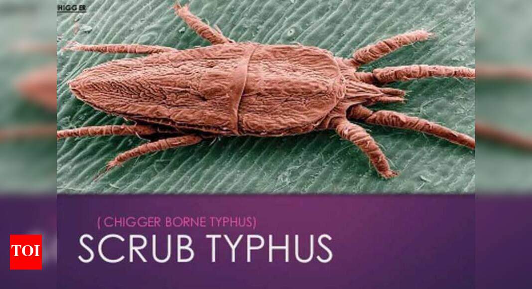 Scrub Typhus, the insect-borne disease | Kolkata News - Times of India