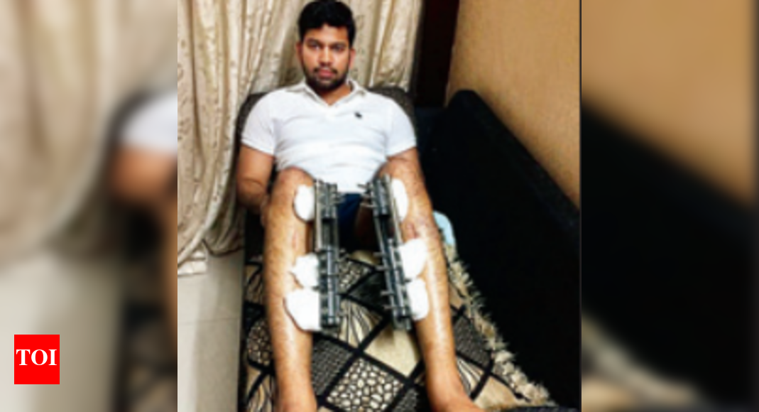 Nikhil Reddy: Nikhil improving, say experts | Hyderabad News - Times of ...
