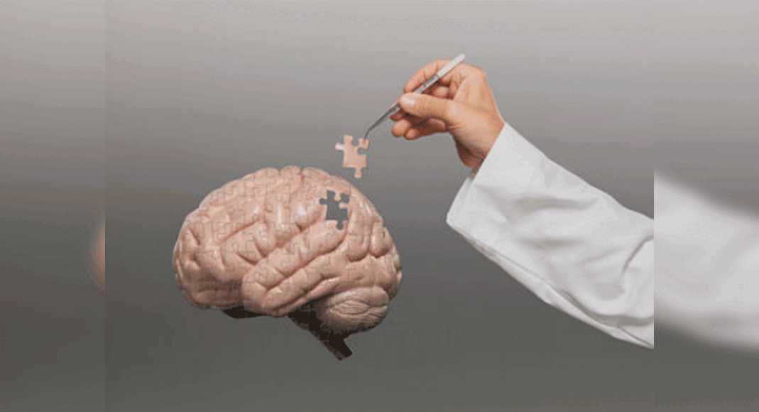 6 natural foods that boost brain health