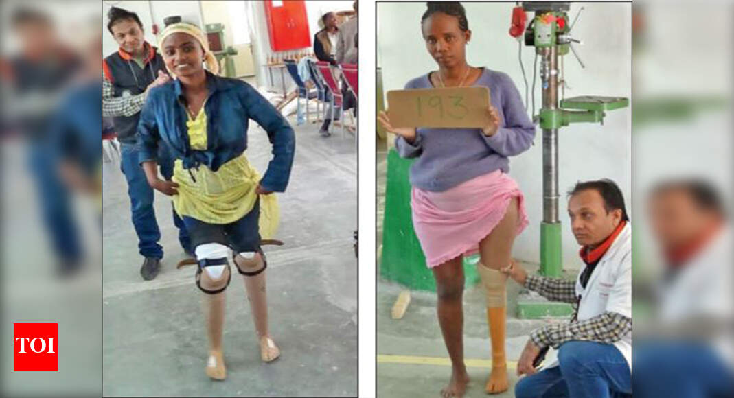 Jaipur Foot helps 700 handicapped Ethiopians walk | Jaipur News - Times ...