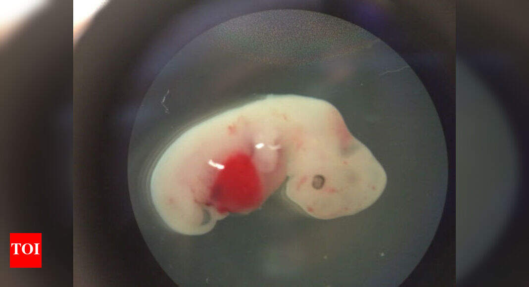 Scientists create first human-pig embryos - The Times of India Scientists create first human-pig embryos - The Times of India