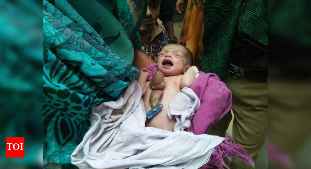 Abnormal Baby: Baby fights for life, and you can see every heartbeat ...