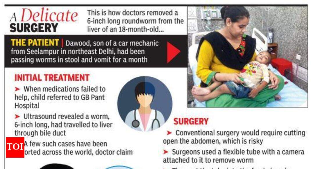 6-inch worm was making baby’s liver sick, pulled out in a rare op ...