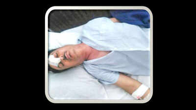 Robbers turn stone pelters | Ahmedabad News - Times of India