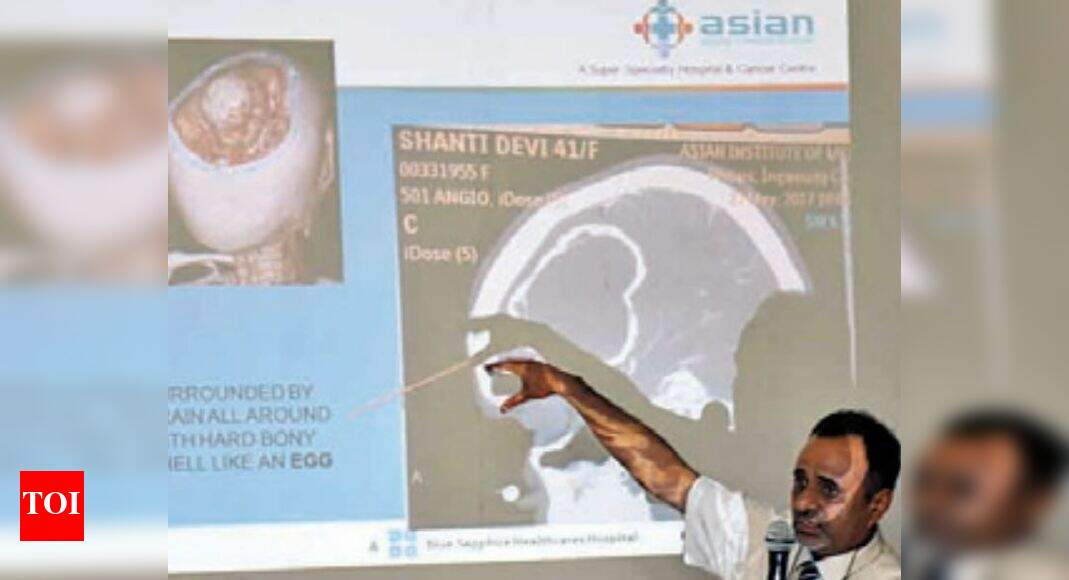 Doctors open skull to remove ‘giant’ cyst from 41-year-old woman’s ...