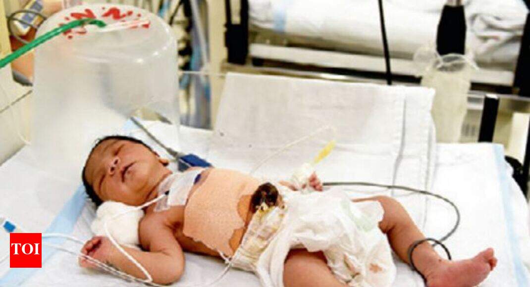 BABY WITH 4 LEGS: Baby with 4 legs, 3 hands undergoes surgery, fine ...